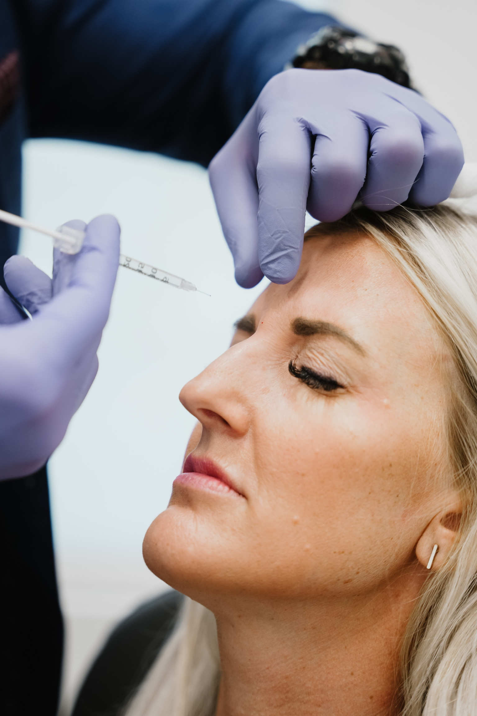 Botox Injections in Draper, UT | The Plastics Clinic